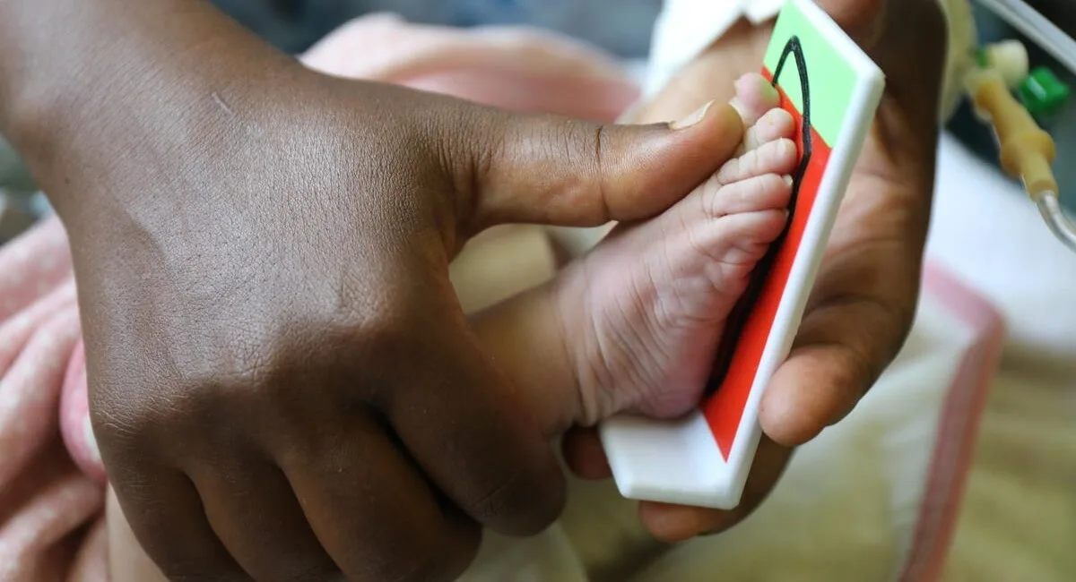 NEW TOOLS MEASURE BABIES’ FEET TO IDENTIFY HOME BIRTHS NEEDING CARE IN ...